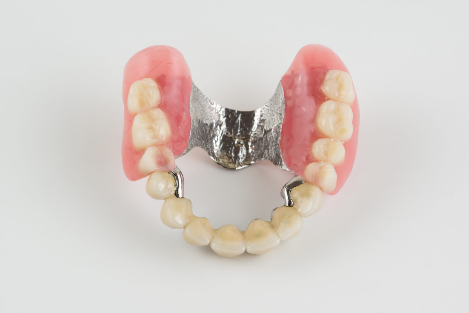 Geschiebe- und Teleskopprothesen - Flexi-Strong-Prothesen